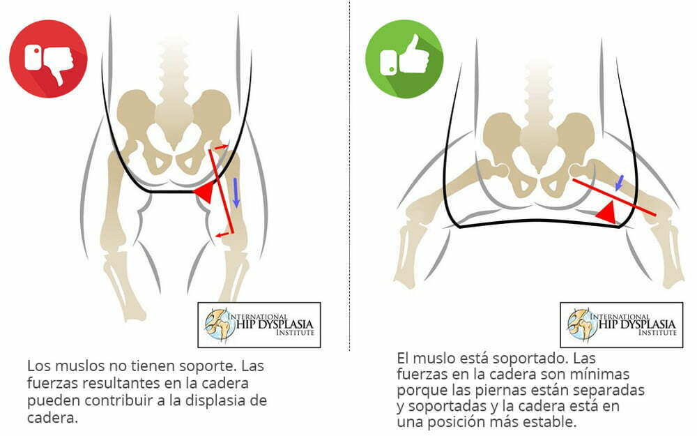Porteo y displasia de cadera - El Arte del Rebozo Porteo y displasia de cadera - El Arte del Rebozo